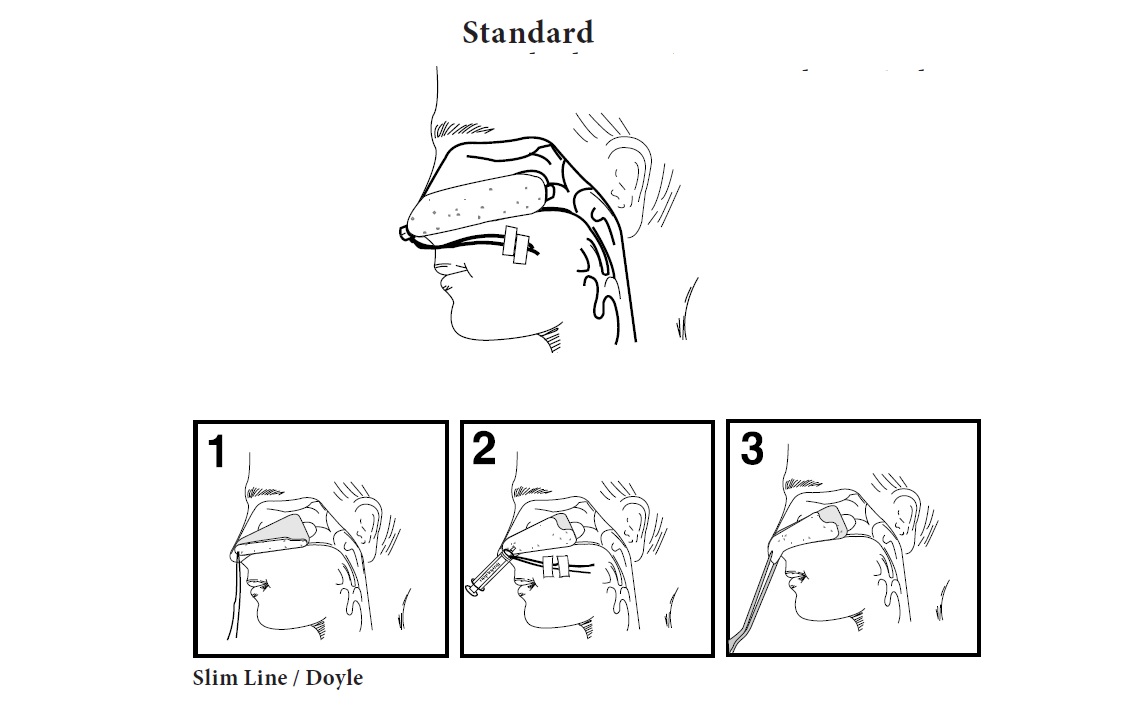 Merocel Standard Nasal Dressing 8cm - Ref 400402 | Buy Online at best ...
